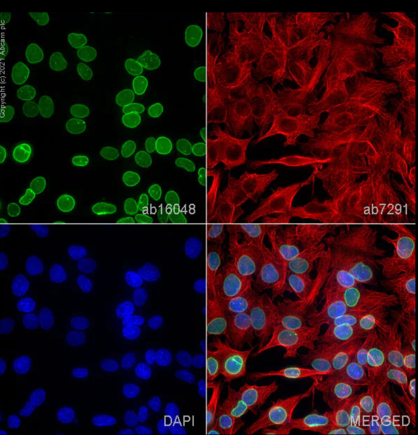 ab7817-Anti-alpha smooth muscle Actin antibody [1A4] - BIO-STATION LIMITED